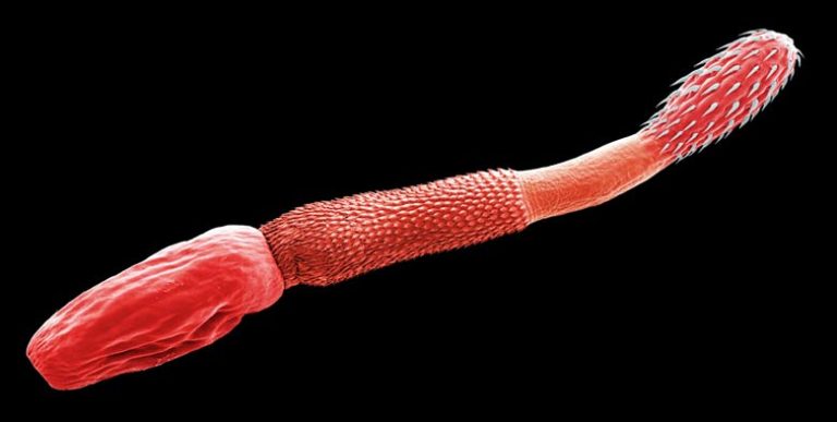 Acanthocephalan | Niewidoczne dla oczu | Blogi DinoAnimals.pl